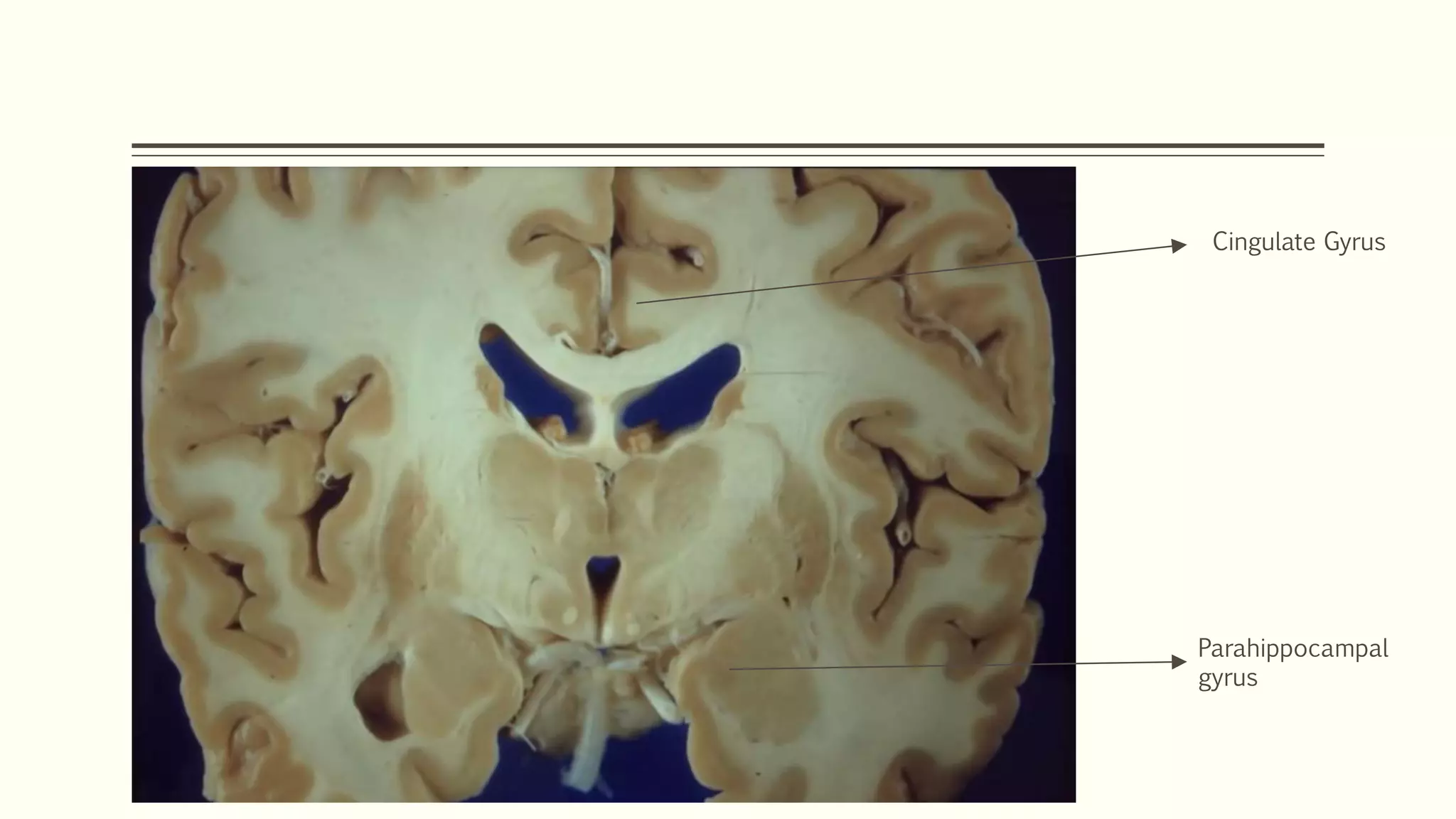Anatomy & Function of Temporal lobe | PPTX