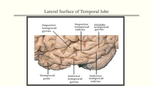 Anatomy & Function of Temporal lobe | PPTX