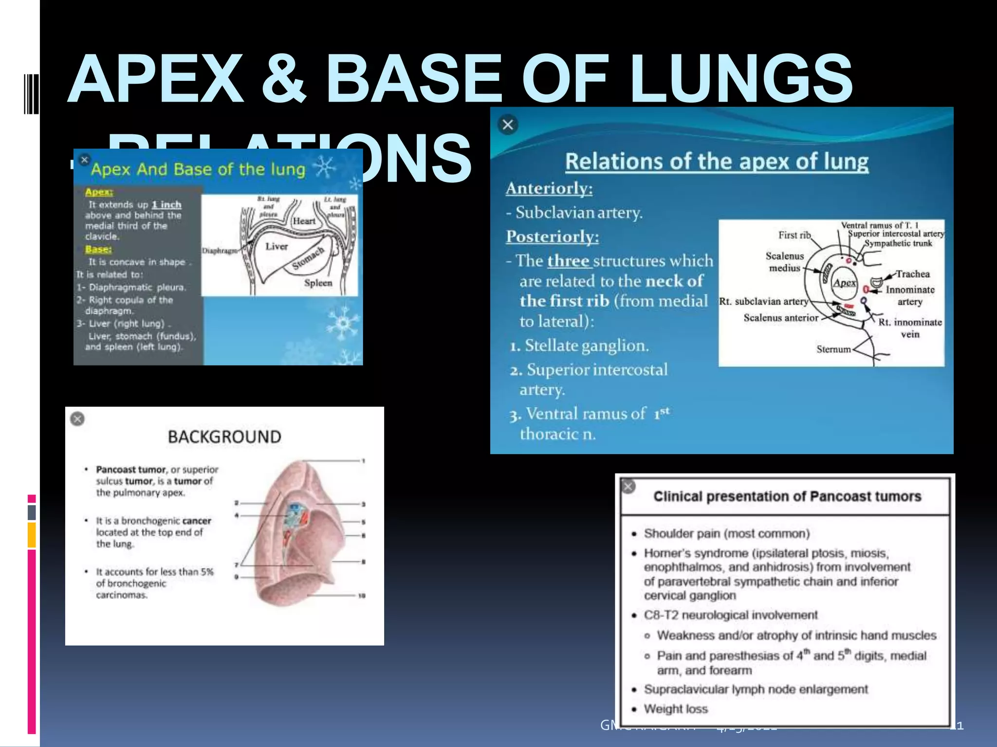 Anatomy lungs | PPTX