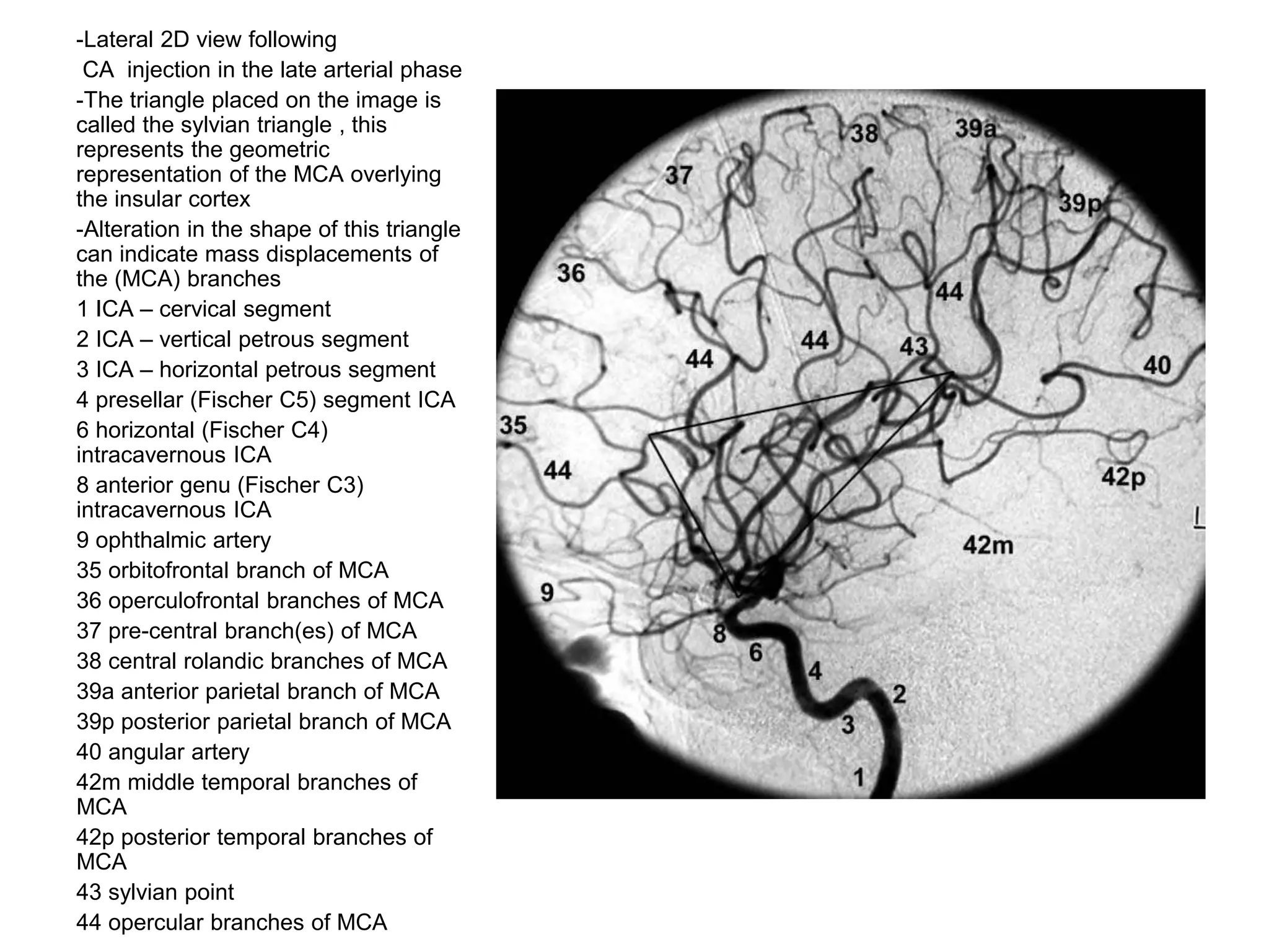 Anatomy of the middle cerebral artery (MCA) | PPT