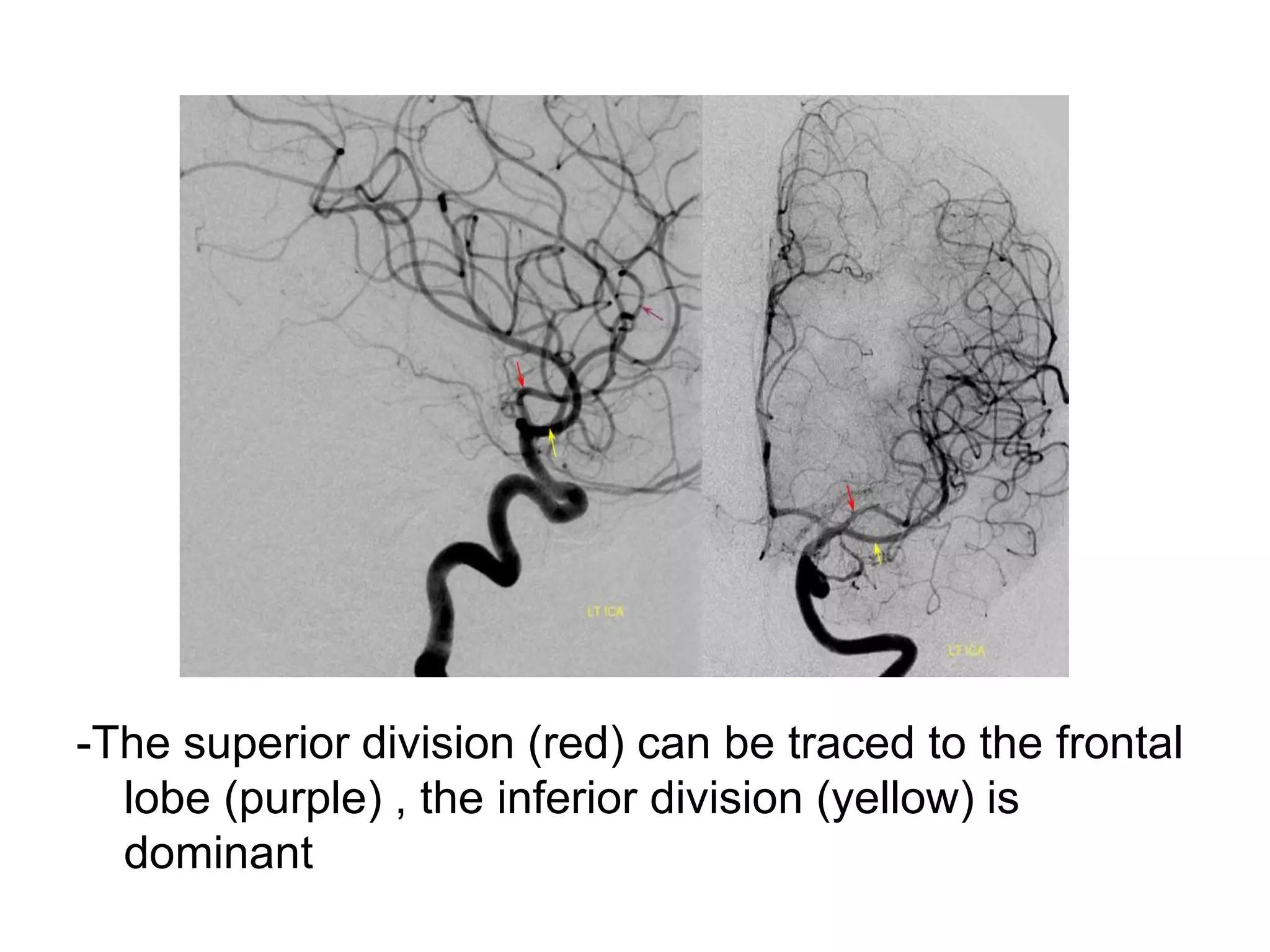 Anatomy of the middle cerebral artery (MCA) | PPT