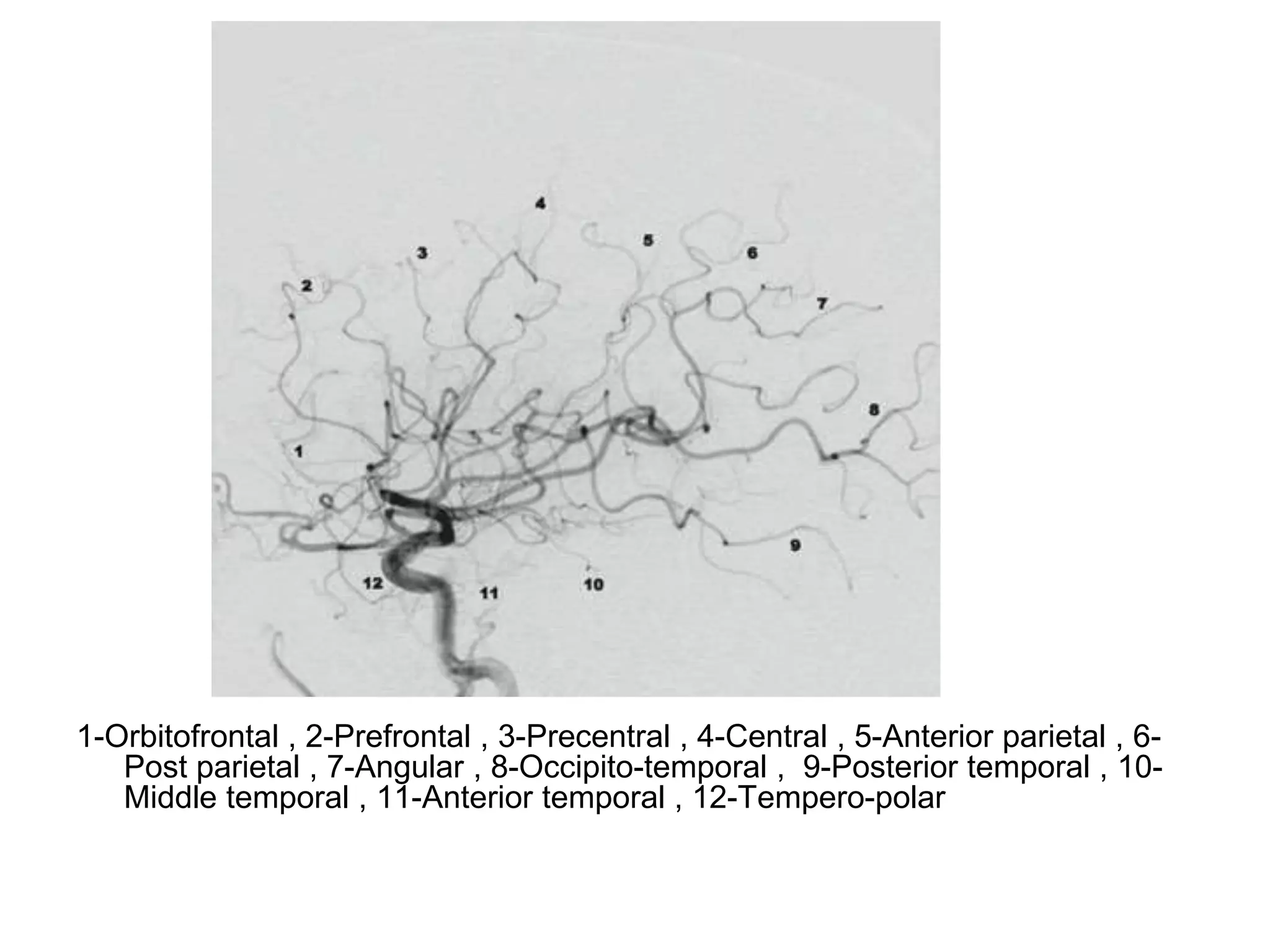 Anatomy of the middle cerebral artery (MCA) | PPT