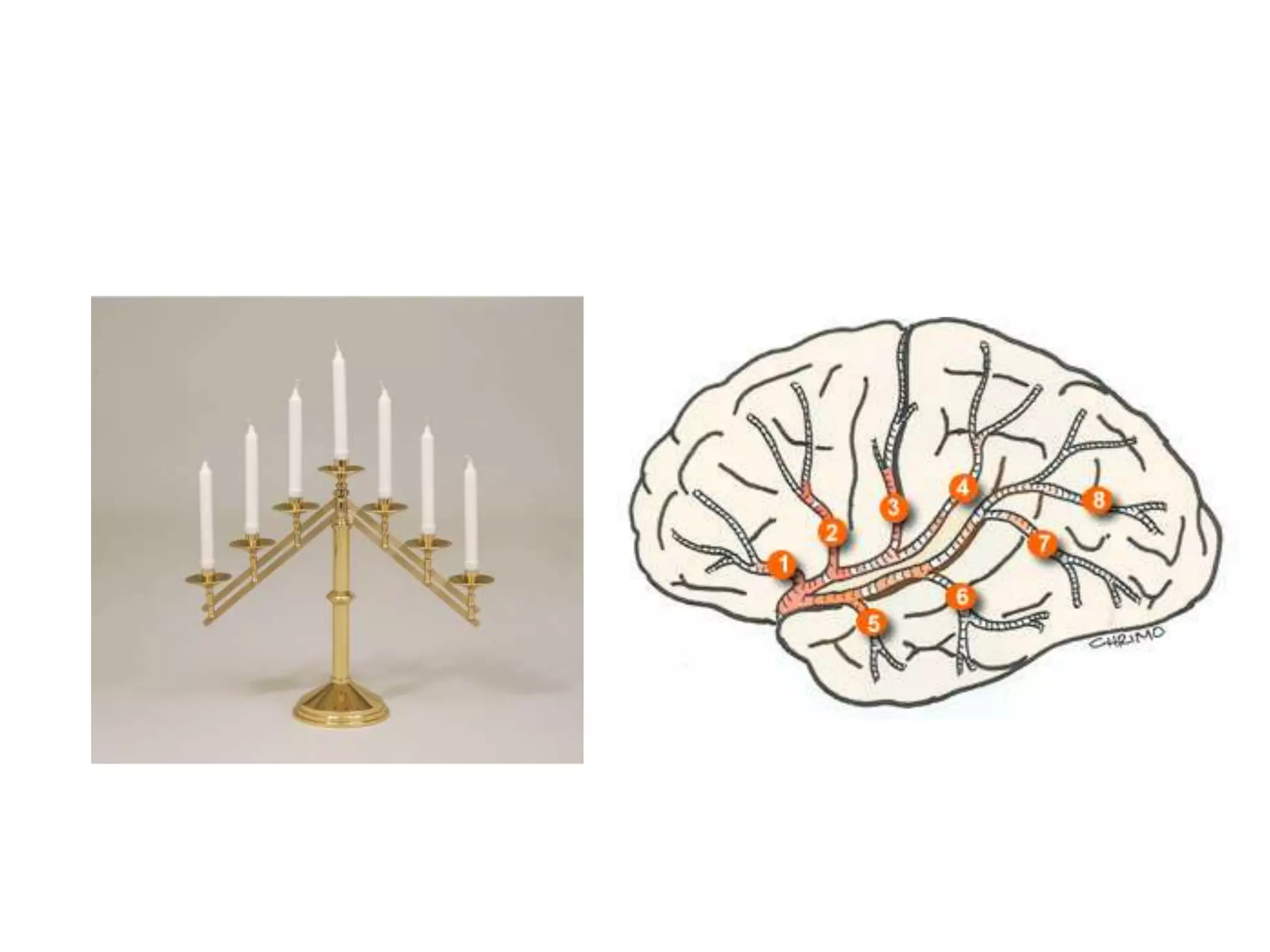 Anatomy of the middle cerebral artery (MCA) | PPT