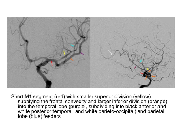 Anatomy of the middle cerebral artery (MCA) | PPT
