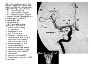 Anatomy of the middle cerebral artery (MCA) | PPT
