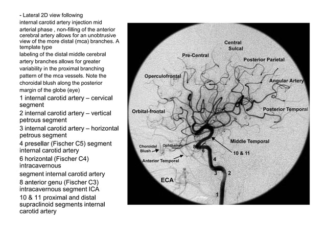 Anatomy of the middle cerebral artery (MCA) | PPT