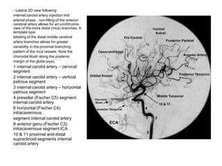 Middle Cerebral Artery Angiogram