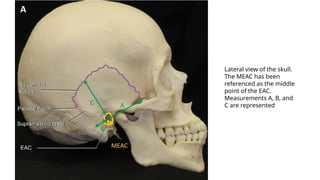 Anatomy Middle Cranial Fossa Kelvin.pptx