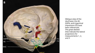 Anatomy Middle Cranial Fossa Kelvin.pptx