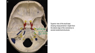 Anatomy Middle Cranial Fossa Kelvin.pptx