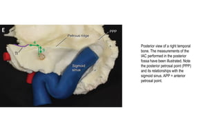 Anatomy Middle Cranial Fossa Kelvin.pptx