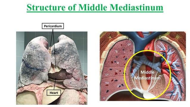 Anatomy (middle mediastinum) | PDF | Lung and Respiratory Health ...