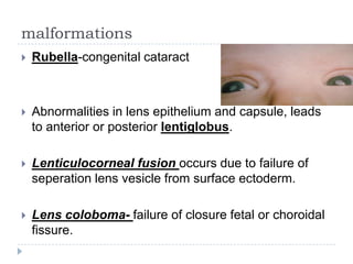 Anatomy and embryology of crystalline lens DrBP | PPTX