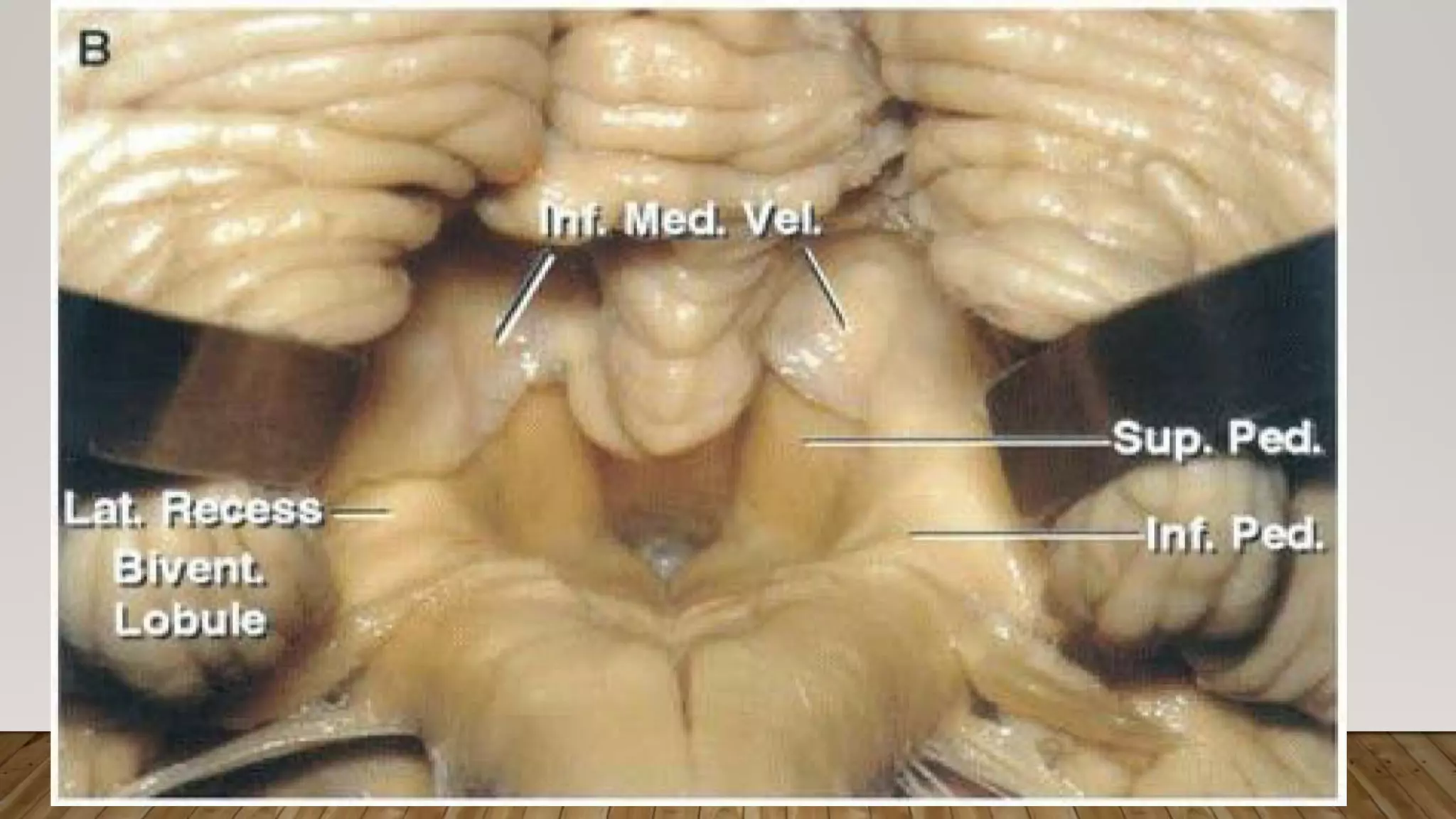 Anatomy of 4th ventricle | PPTX
