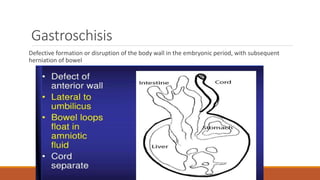 Anatomy of Abdominal wall and Inguinal region.pptx