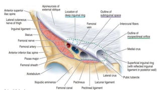 Anatomy of Abdominal wall and Inguinal region.pptx