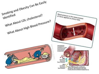 Anatomy of a heart attack | PPT
