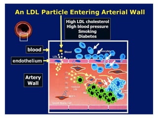 Anatomy of a heart attack | PPT