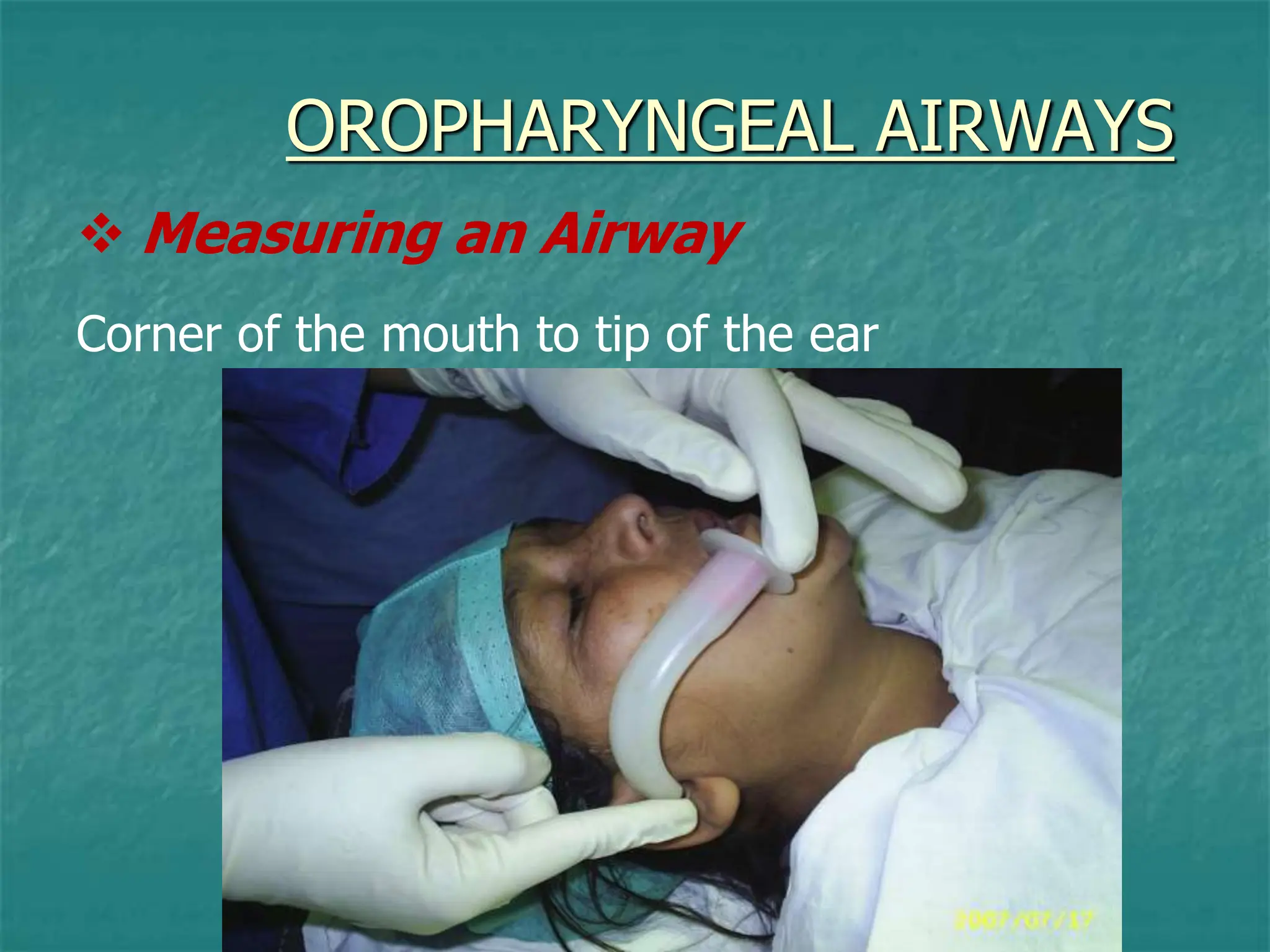 Anatomy of Airway adults versus paediatrics.ppt