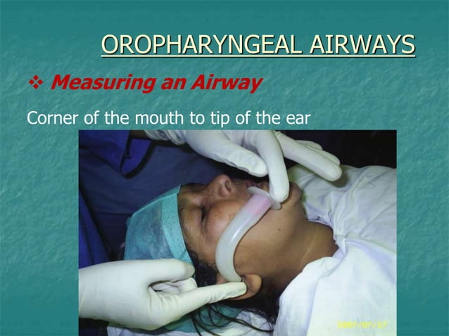 Anatomy of Airway adults versus paediatrics.ppt | Ear, Nose and Throat ...