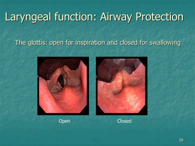 Anatomy of Airway adults versus paediatrics.ppt | Ear, Nose and Throat ...