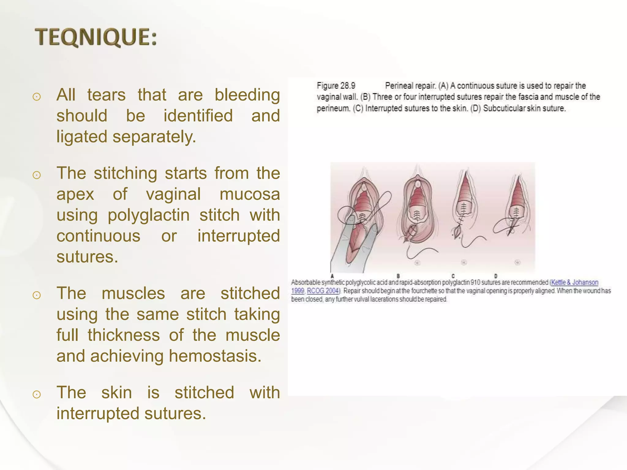 Anatomy of anal sphincter and perineal body | PPTX