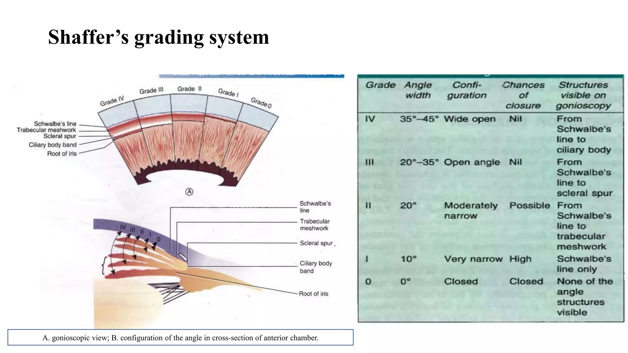 Anatomy of Angle of Anterior chamber.pptx