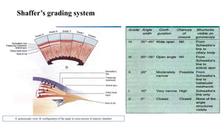 Anatomy of Angle of Anterior chamber.pptx