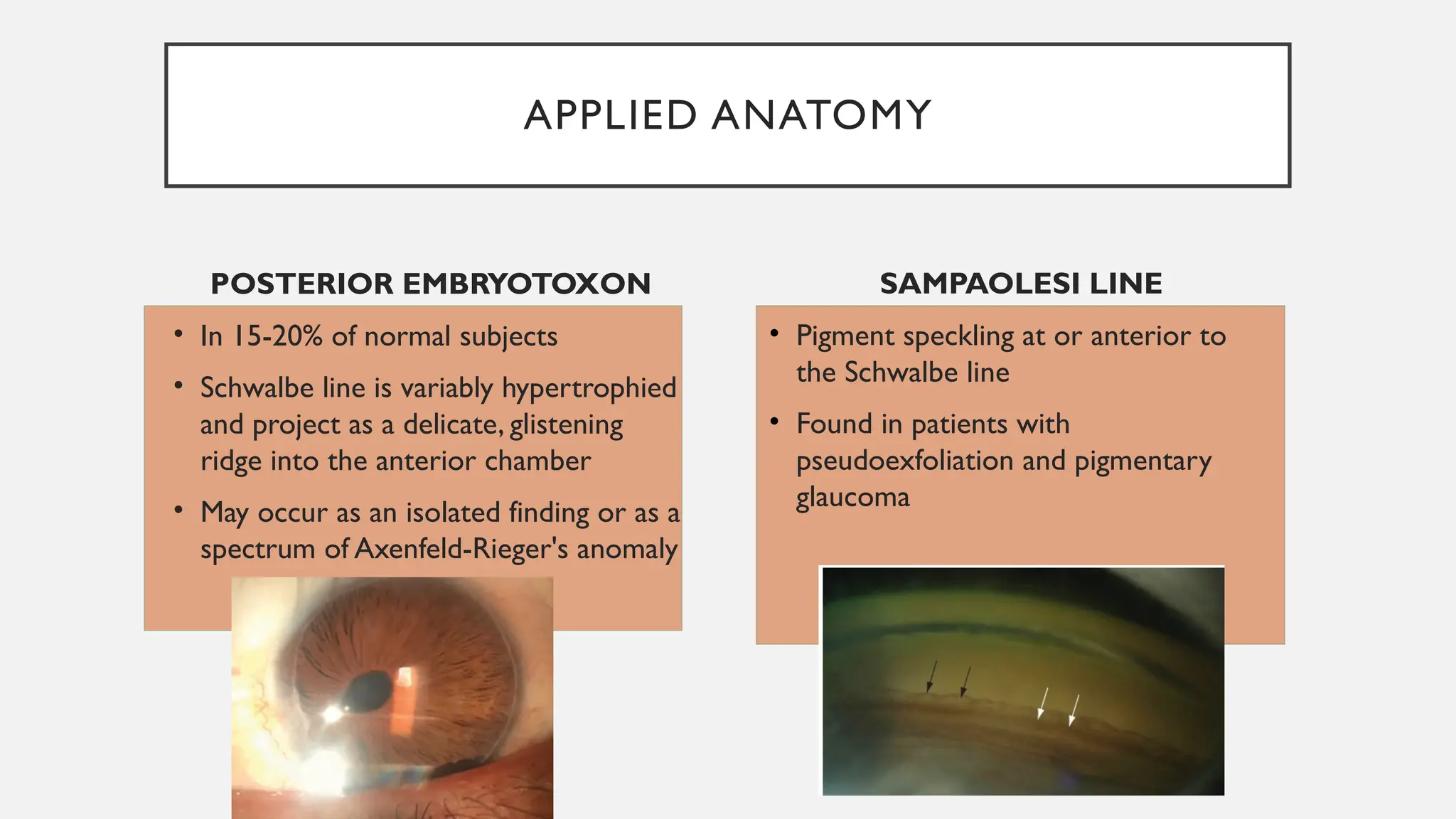 ANATOMY OF ANGLE OF ANTERIOR CHAMBER dr sanjana.pptx