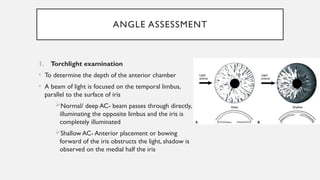 ANATOMY OF ANGLE OF ANTERIOR CHAMBER dr sanjana.pptx
