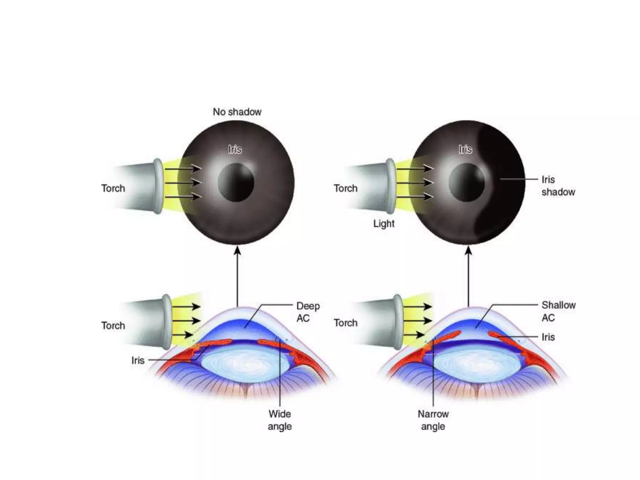 Anatomy of anterior chamber angle (1) | PPTX