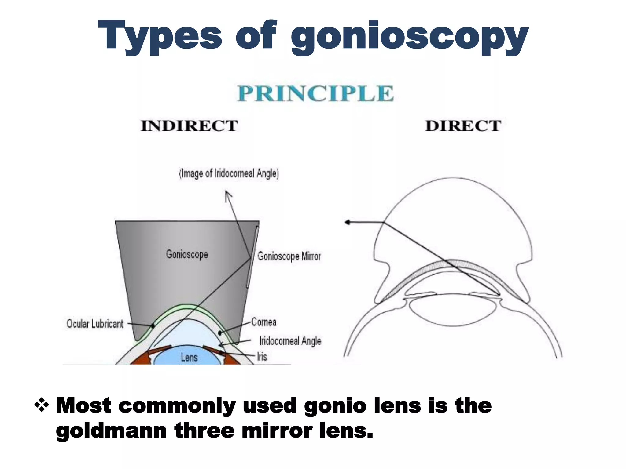 Anatomy of anterior chamber angle (1) | PPTX