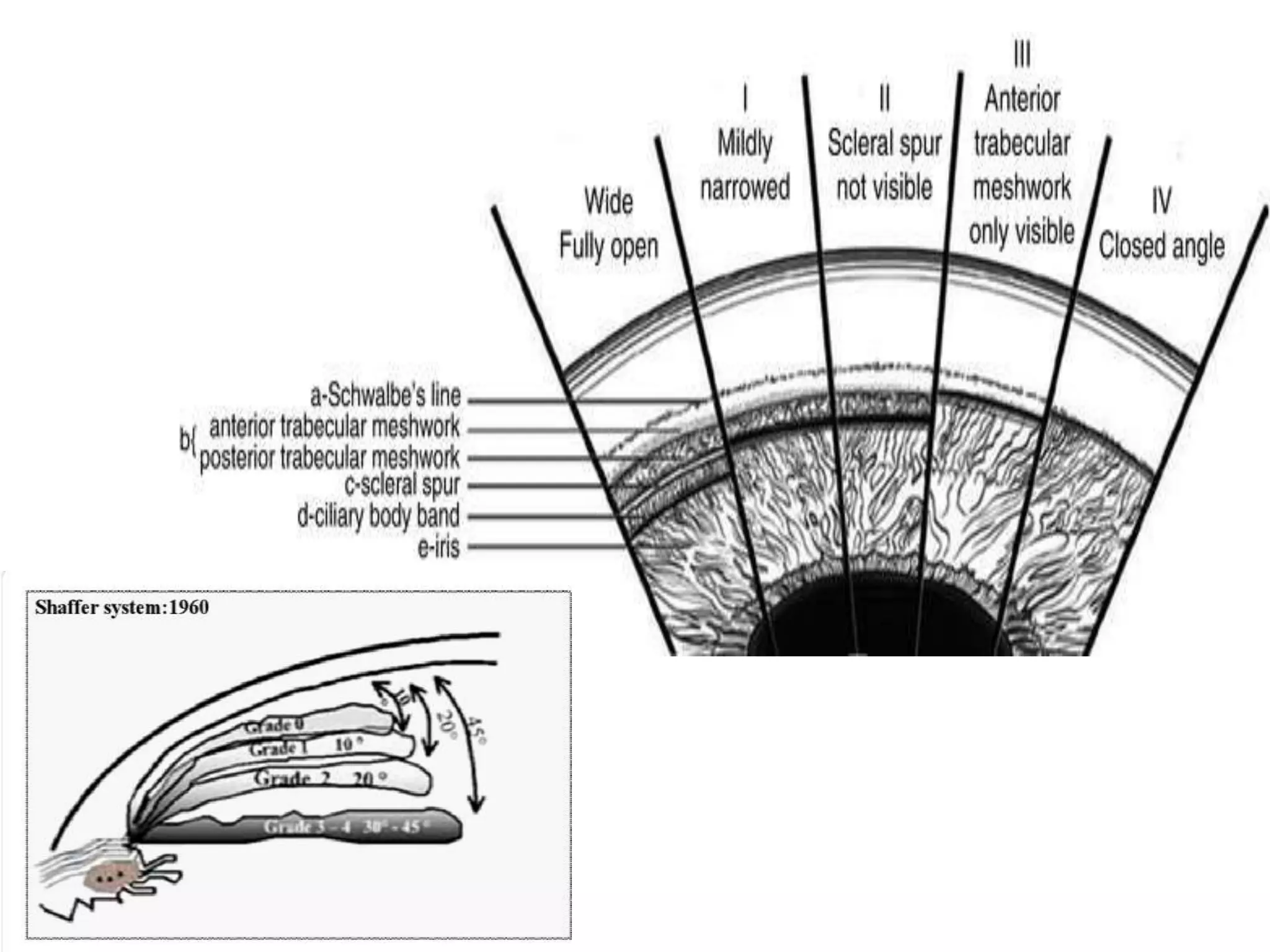 Anatomy of anterior chamber angle (1) | PPTX