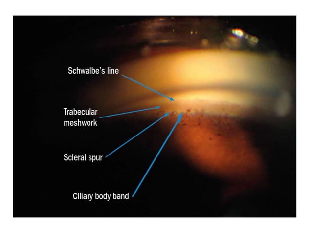 Anatomy of anterior chamber angle (1) | PPTX