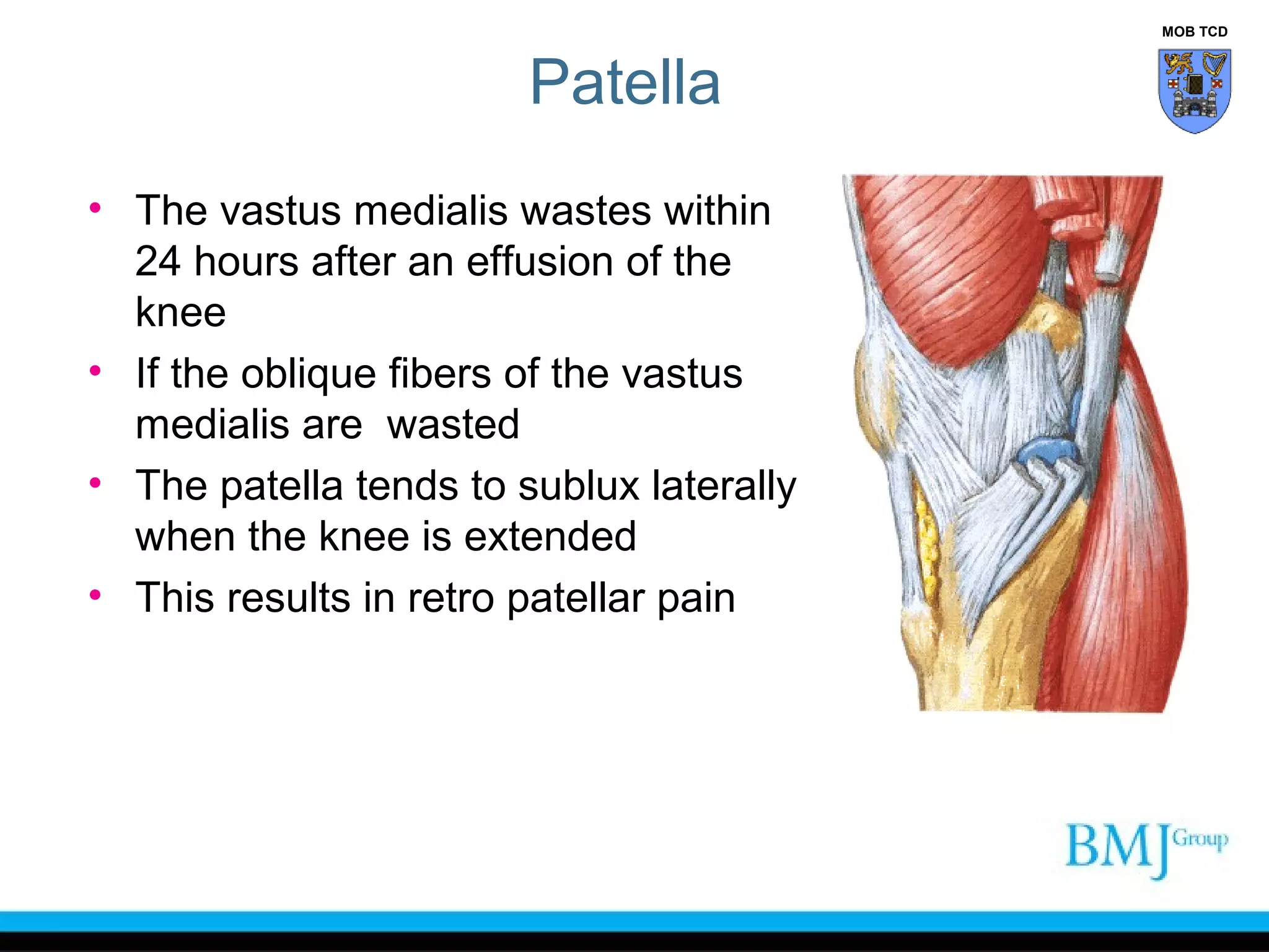 Anatomy of anterior_cruciate_ligament | PPT