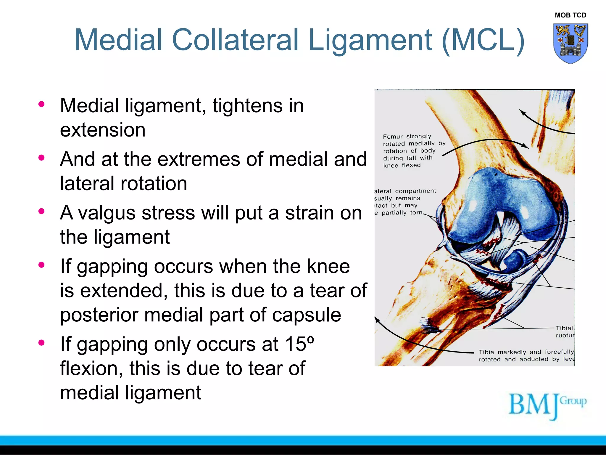 Anatomy of anterior_cruciate_ligament | PPT