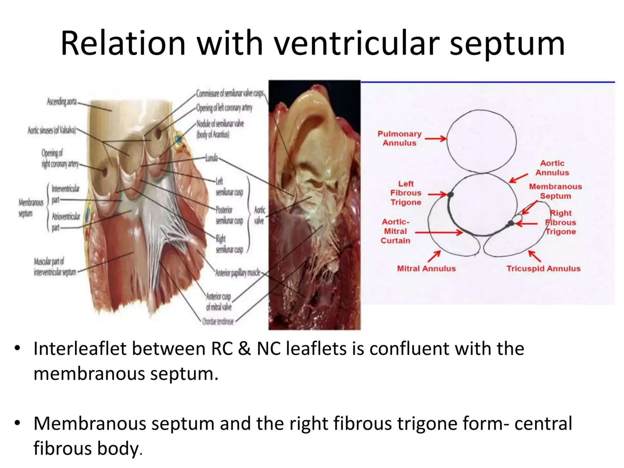 Anatomy Of Aortic Valve- Dr Garv Ameta (1).pptx