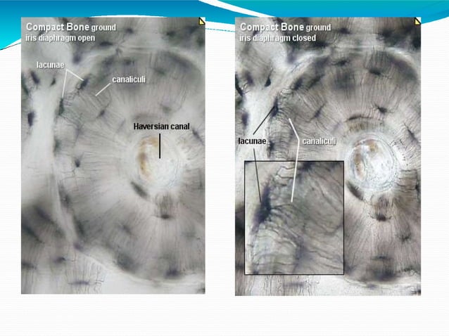 Anatomy Of Bone and CarDFGFHGJKL;JHtilage.pptx
