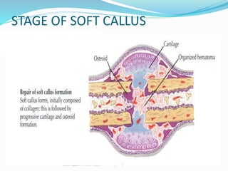 Anatomy of bone and cartilage 1 | PPTX