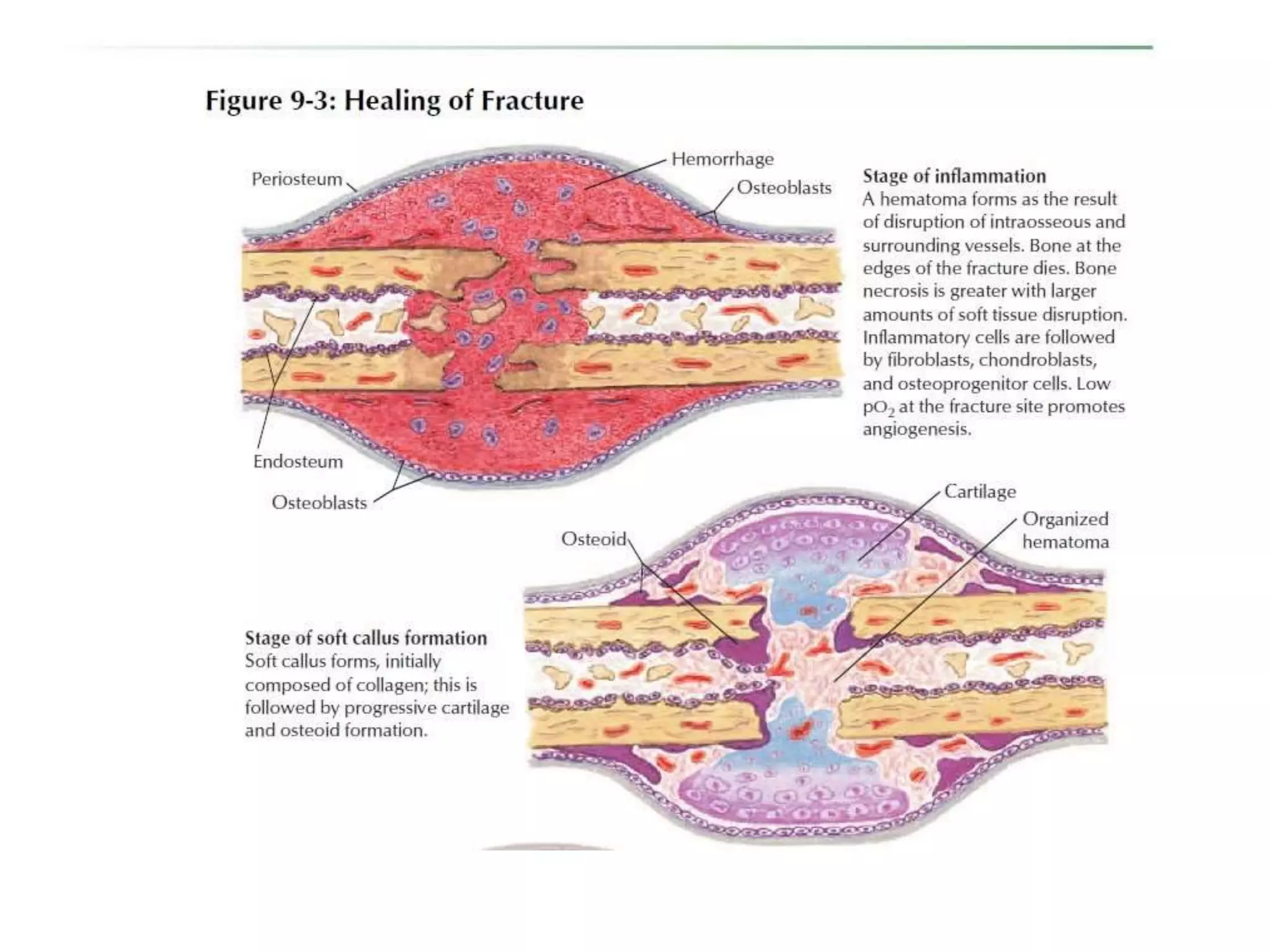 Anatomy of Bone and Fracture Healing.ppt