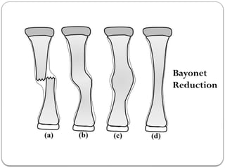 Anatomy of Bone and Fracture Healing.pptx