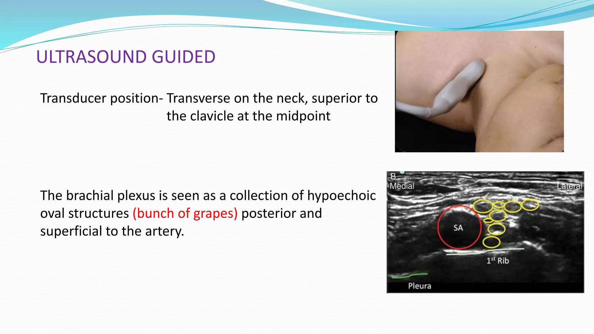 Anatomy of brachial plexus | PPTX