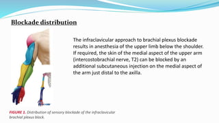 Anatomy of brachial plexus | PPTX