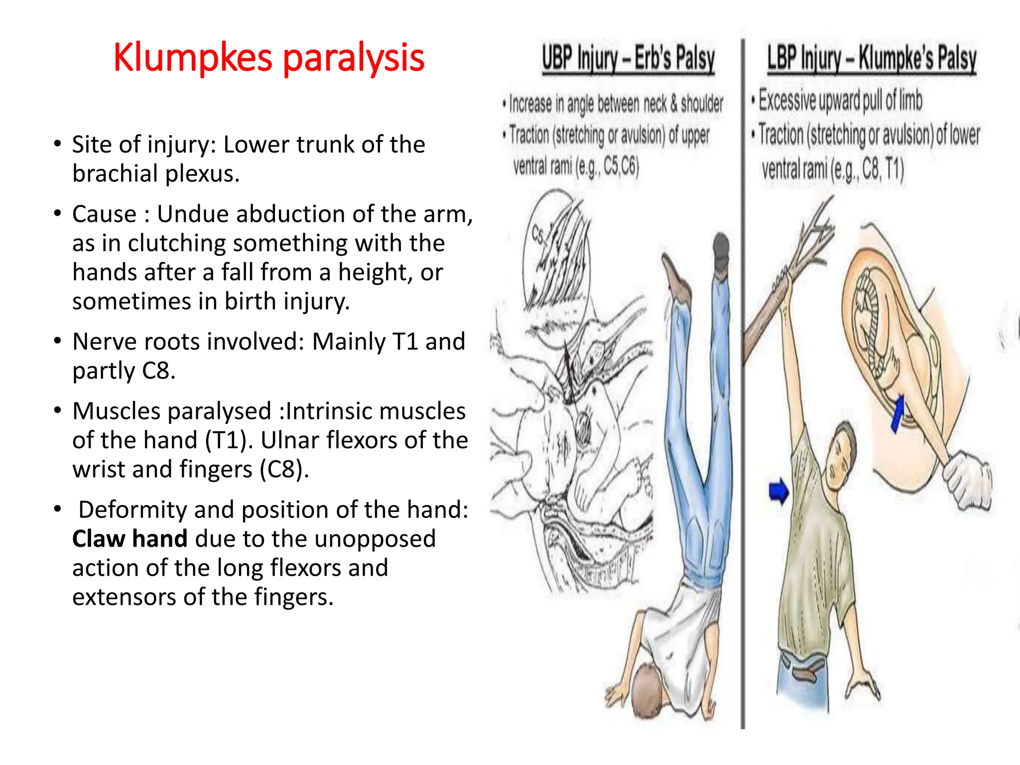 ANATOMY OF BRACHIAL PLEXUS presentation.pptx