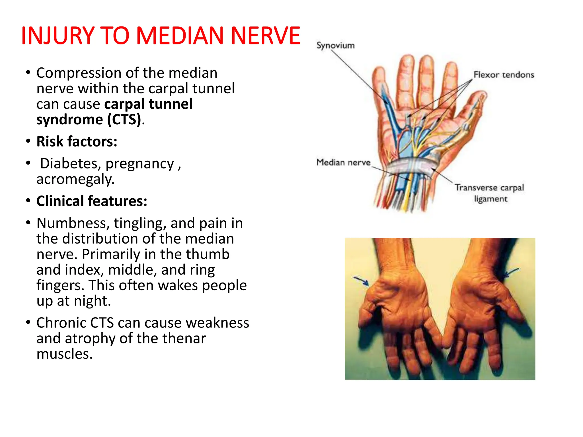 ANATOMY OF BRACHIAL PLEXUS presentation.pptx