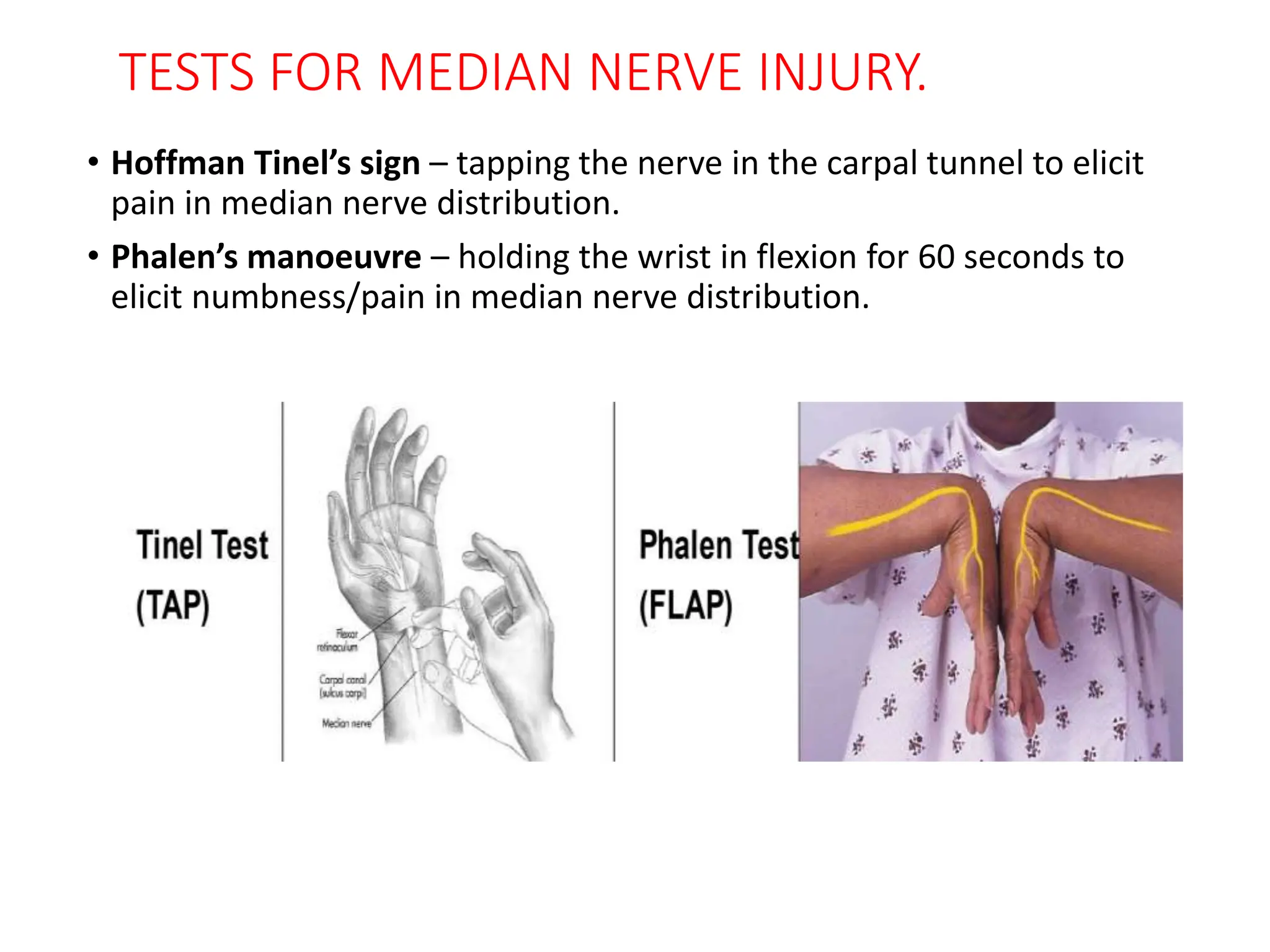 ANATOMY OF BRACHIAL PLEXUS presentation.pptx