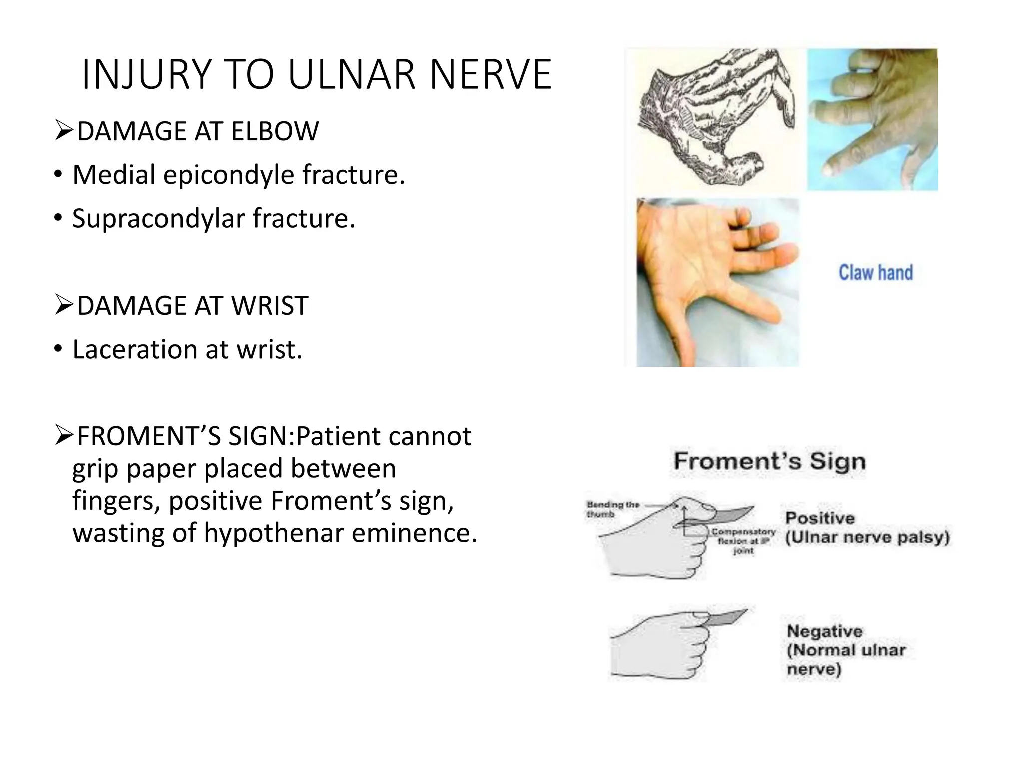 ANATOMY OF BRACHIAL PLEXUS presentation.pptx
