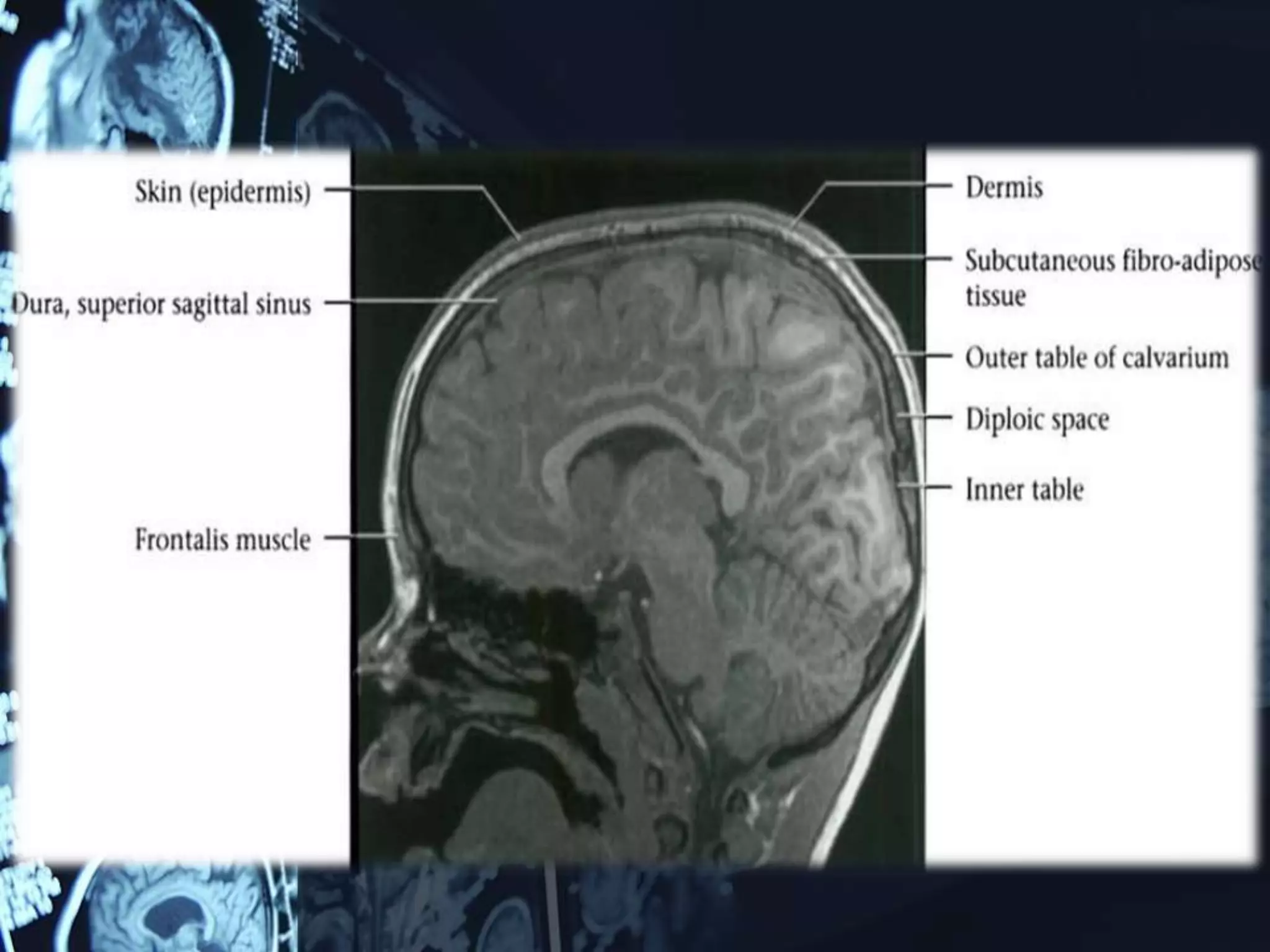 Anatomy of Brain.pptx