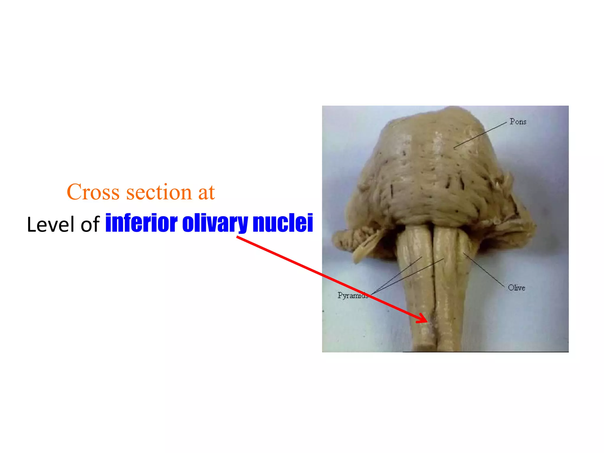 Anatomy of brainstem and its clinical significance | PPTX