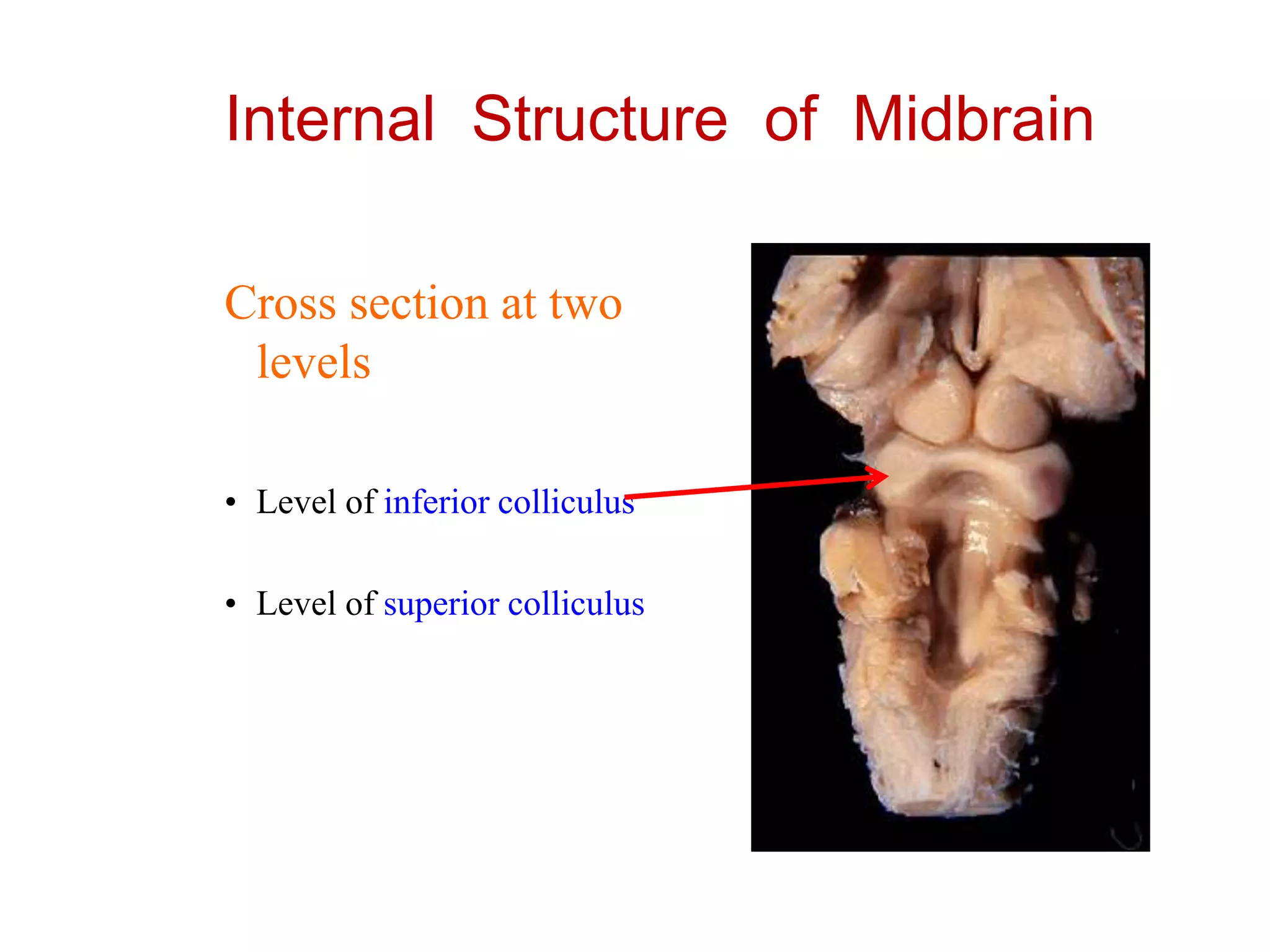 Anatomy of brainstem and its clinical significance | PPTX